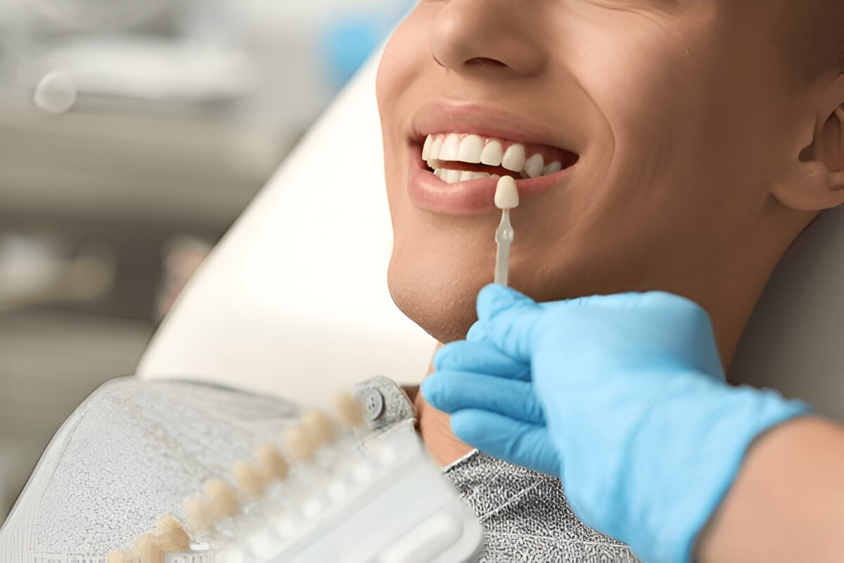 Dental Veneers in Rowville | A Natural, Confident Smile